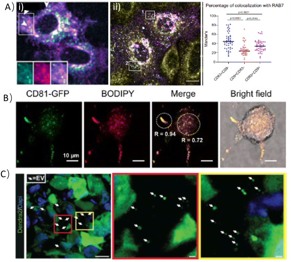 荧光标记的细胞外囊泡在体内和体外的不同生物应用Fluorescence labeling of extracellular vesicles ...