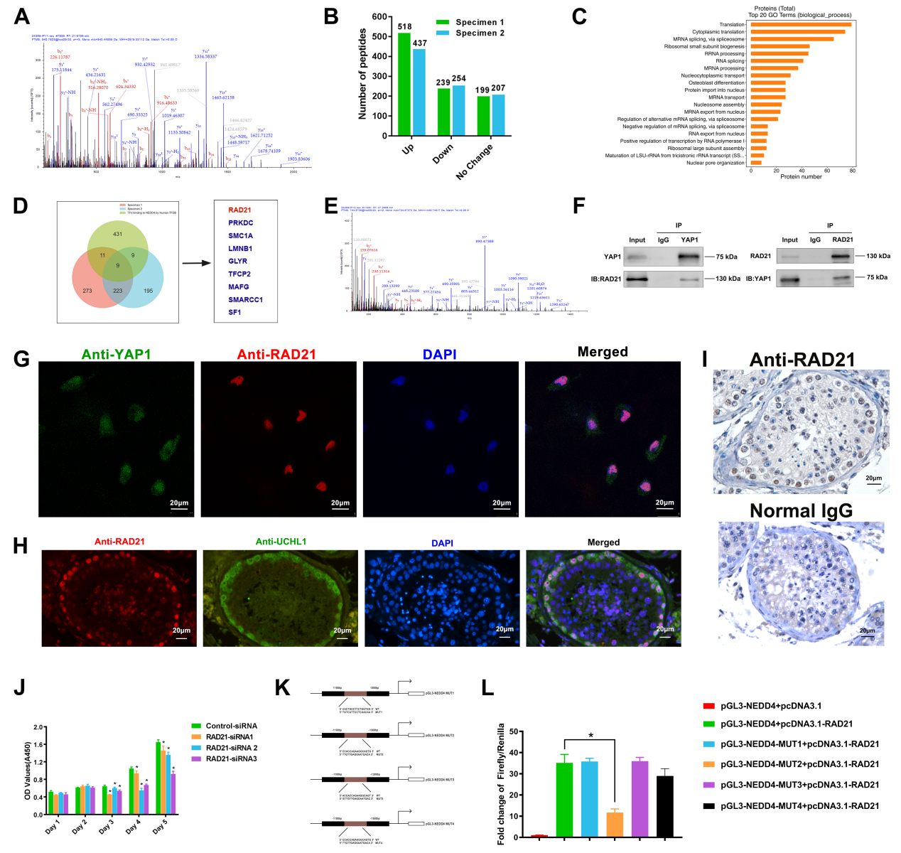 何祖平研究团队发现YAP1与RAD21相互作用靶向NEDD4调控人精原干细胞的命运决定和男性不育的新机制[2024, Research]-海南 ...